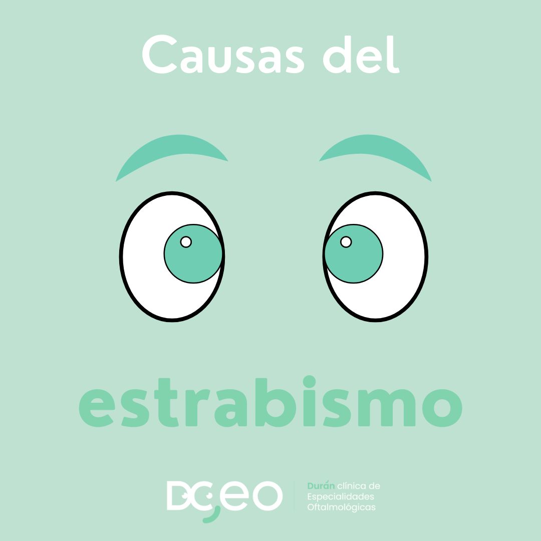 Causas del estrabismo • Clínica Oftalmológica DCEO