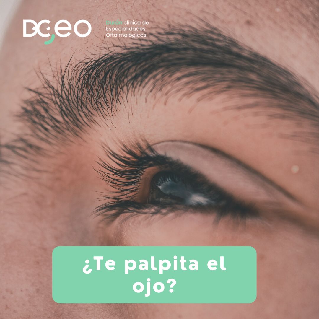 ¿Te palpita el ojo? • Clínica Oftalmológica DCEO
